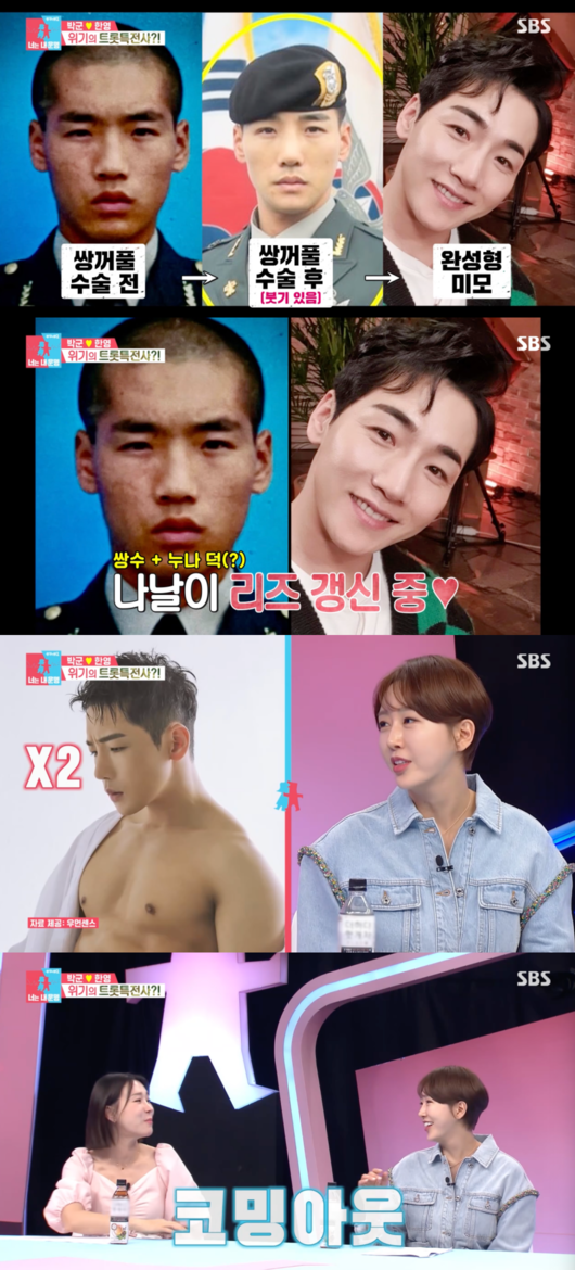 박군 성형 전후 - 유머/이슈 - YULDO